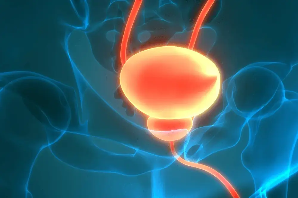 Top Bladder Cancer Treatment In Winnipeg, MB | MHC Manitoba